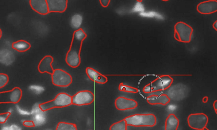 New open-source tool helps to detangle the brain | MIT News | Massachusetts Institute of Technology